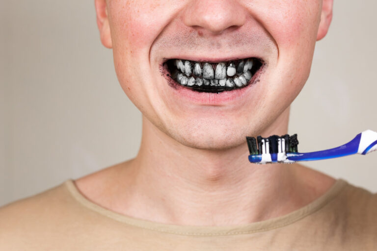 Does Charcoal Toothpaste Really Work? - Ponce Dental Studio